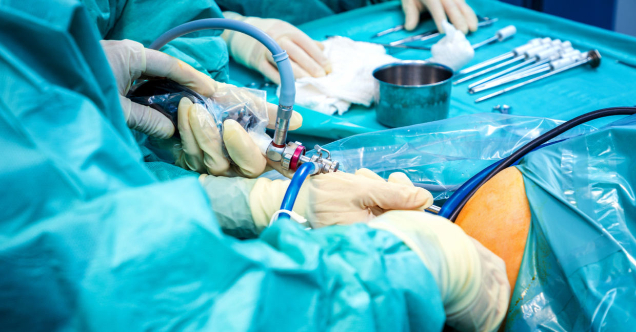 New Bio Glue Stops Post-Traumatic Bleeding in Just Seconds - Goodnet