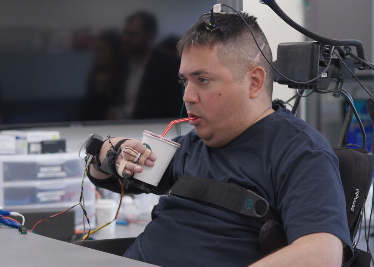 An Innovative Procedure is Restoring Touch to People Who are Paralyzed ...